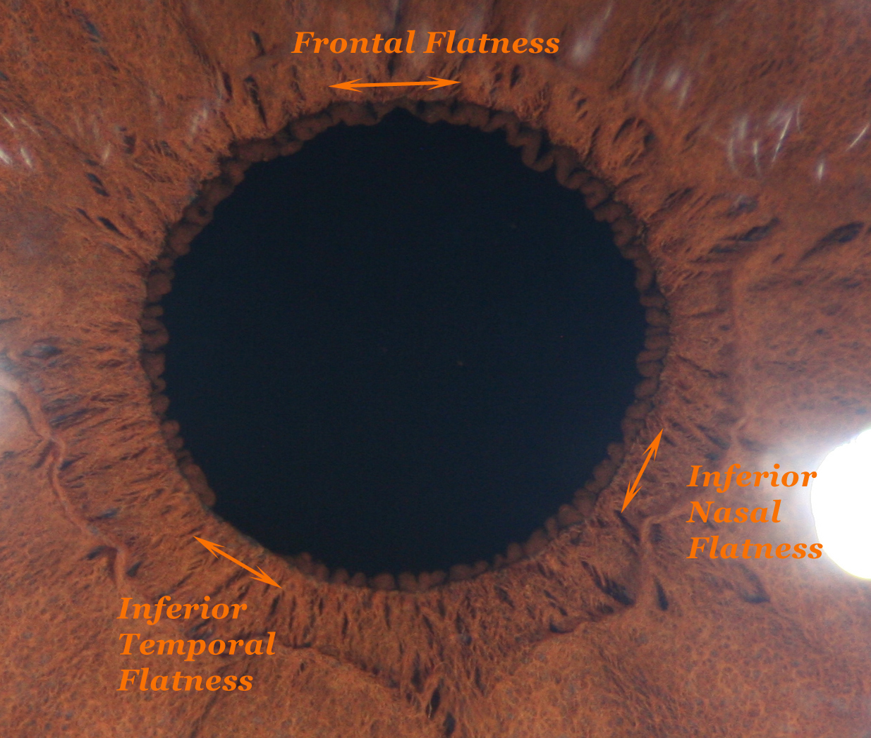 Modern & Multidimensional Iridology: The Pupil, IPB, Pupillary Zone ...