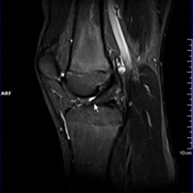 Knee MRI - RadTechOnDuty