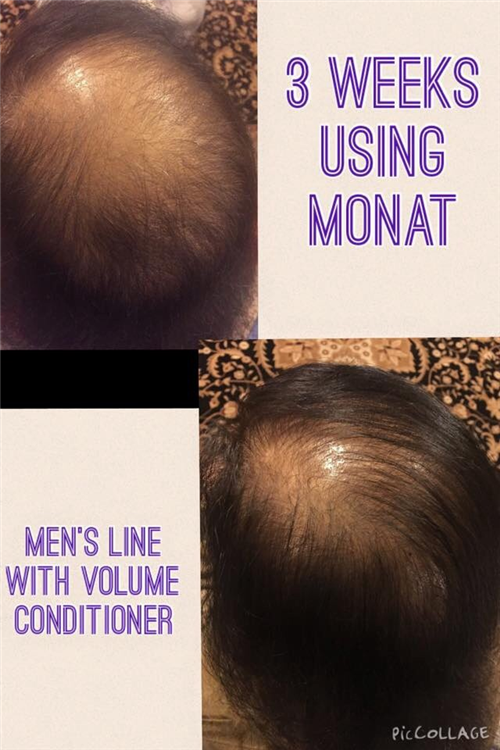 MONAT Global Revolutionary Hair Care Products: Amazing MONAT Before and ...