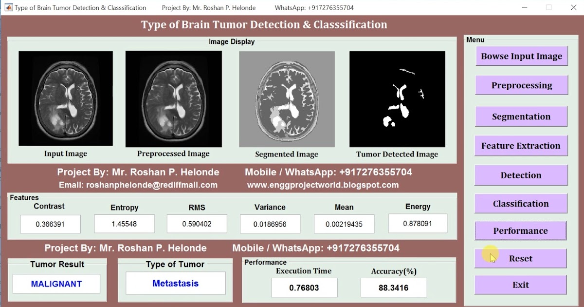 Types of Brain Tumor Detection and Classification Using Image ...
