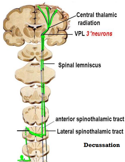 Anterolateral spinothalamic track (pain pathway)
