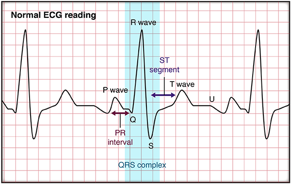 PHARMACO PLUS: ERRATIC HEART BEAT (ARRHYTHMIA)