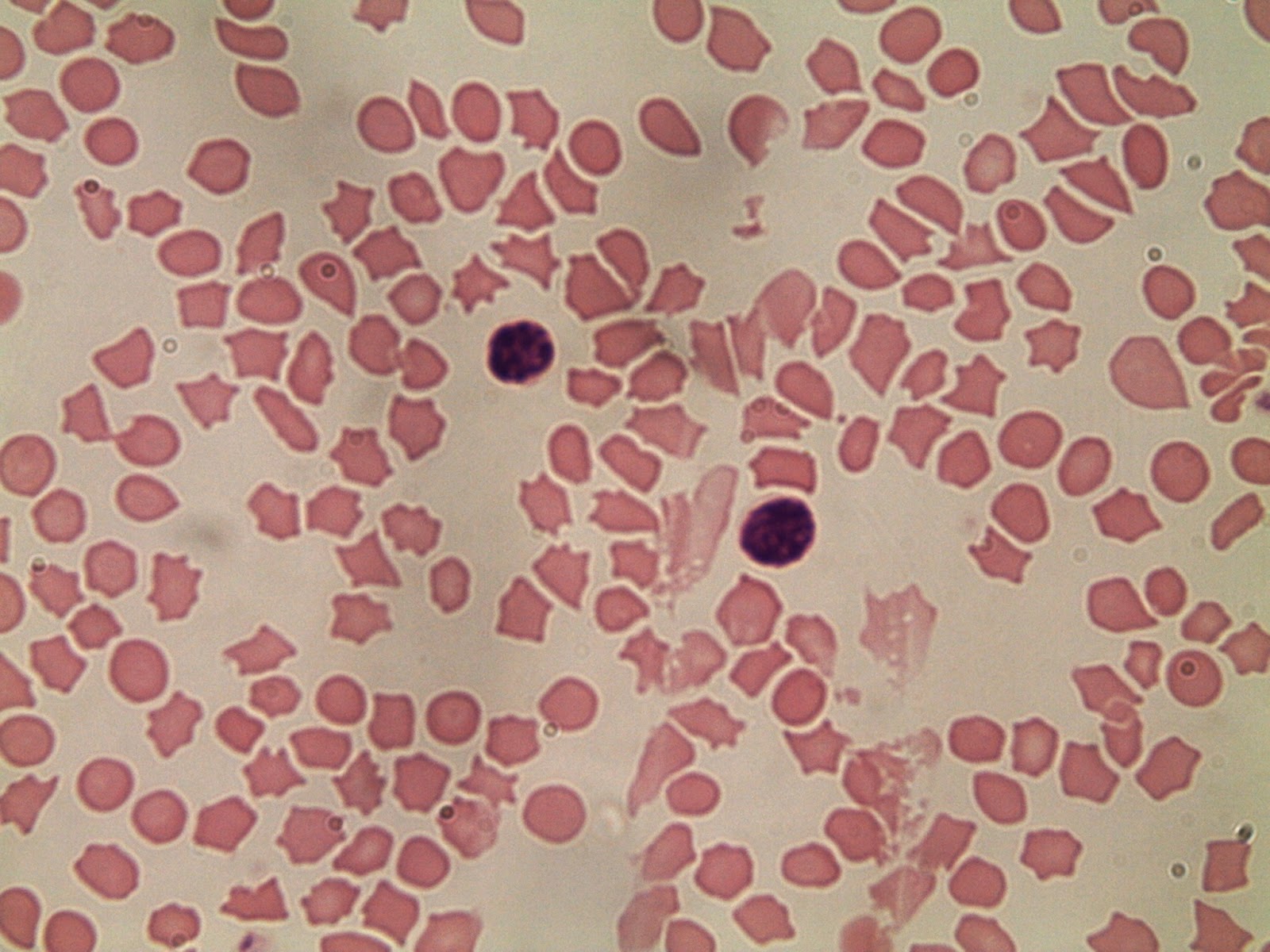 Sangre | Histología Veterinaria Universidad de Antioquia