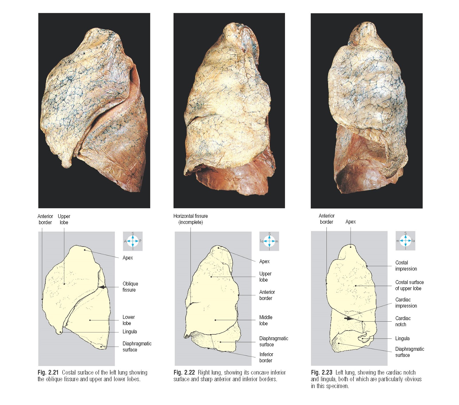 Lungs Anatomy - pediagenosis