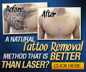 dmso tattoo removal