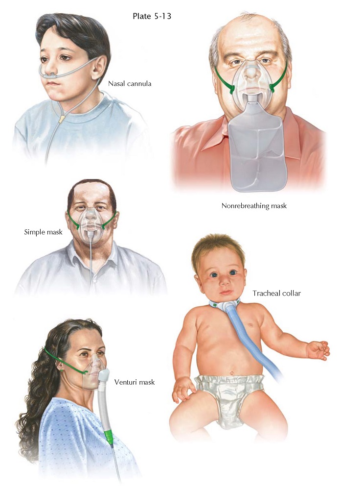 METHODS OF OXYGEN ADMINISTRATION - pediagenosis