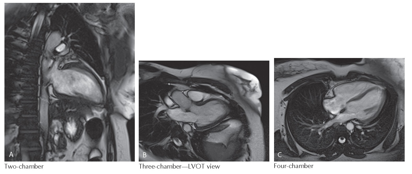 CARDIAC MAGNETIC RESONANCE IMAGING - pediagenosis