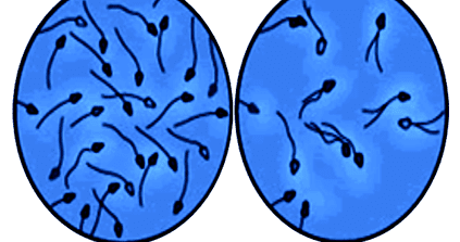 Mohak Infertility Center: OLIGOSPERMIA : ITS CAUSES SYMPTOMS AND TREATMENT