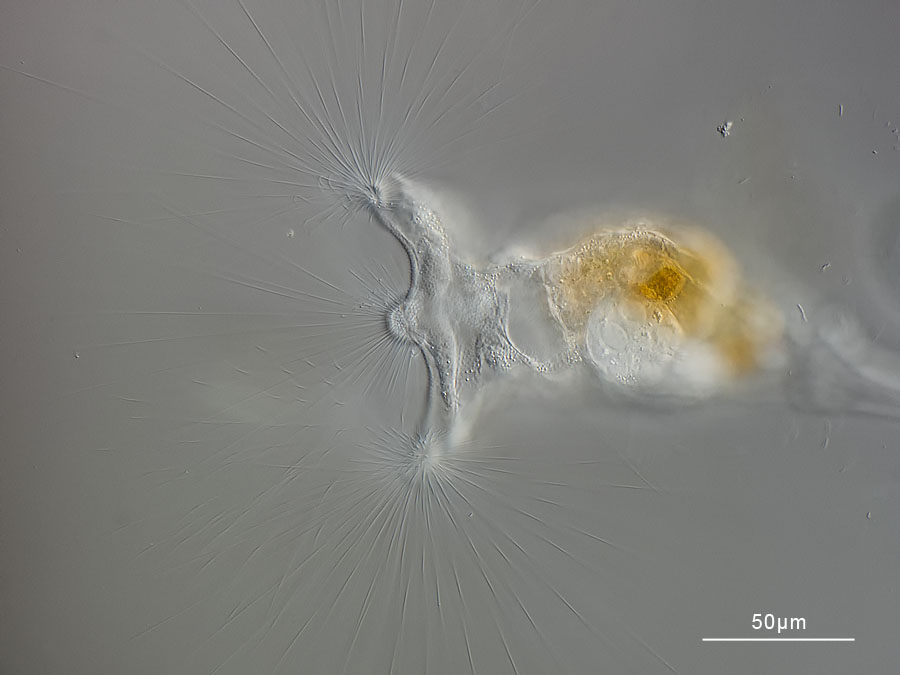明石・神戸の虫 ときどきプランクトン2: ハナビワムシの一種（Collotheca sp.）