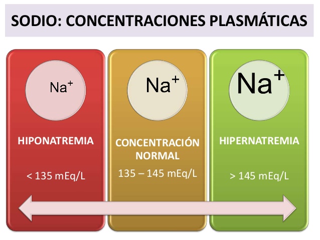 Hiponatremia en paciente hospitalizado - Casos Clínicos