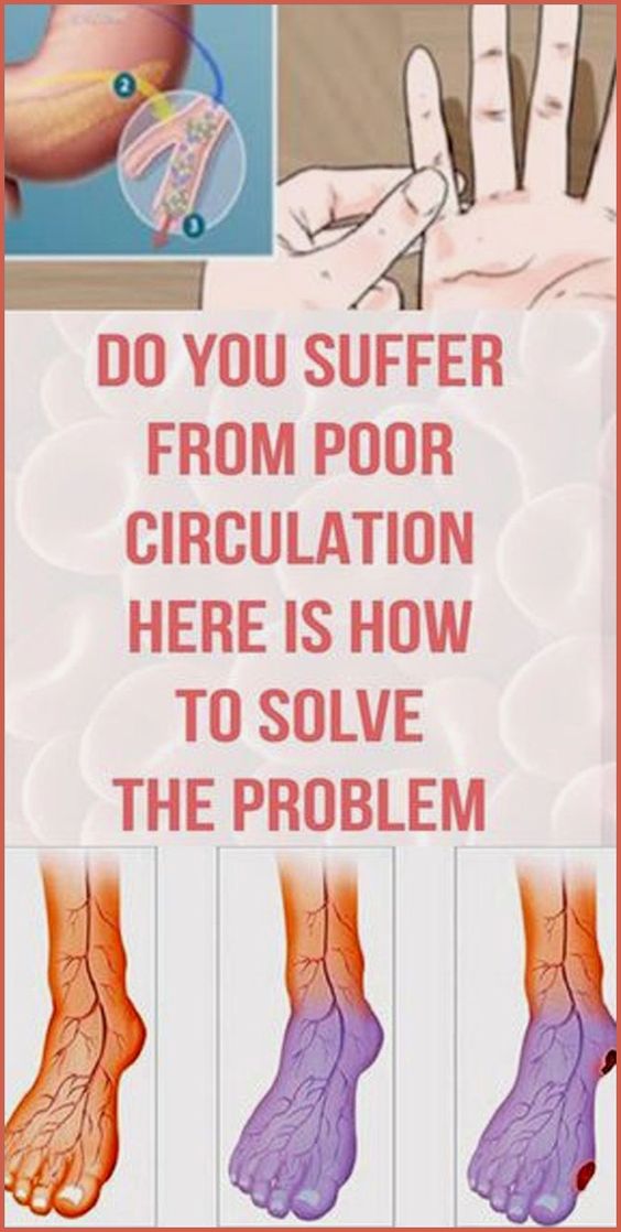 Do You Suffer From Poor Circulation? Here’s How To Solve The Problem ...