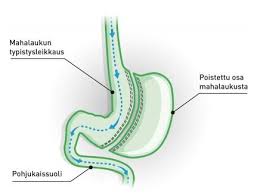 Matka pullukasta pieneksi: 2019