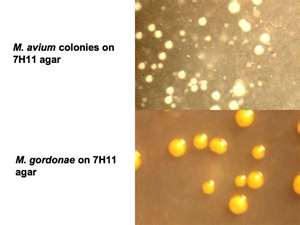 Mycobacterium gordonae - Alchetron, The Free Social Encyclopedia