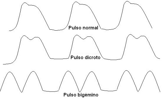CLASES DE MEDICINA: APARATO CARDIOVASCULAR