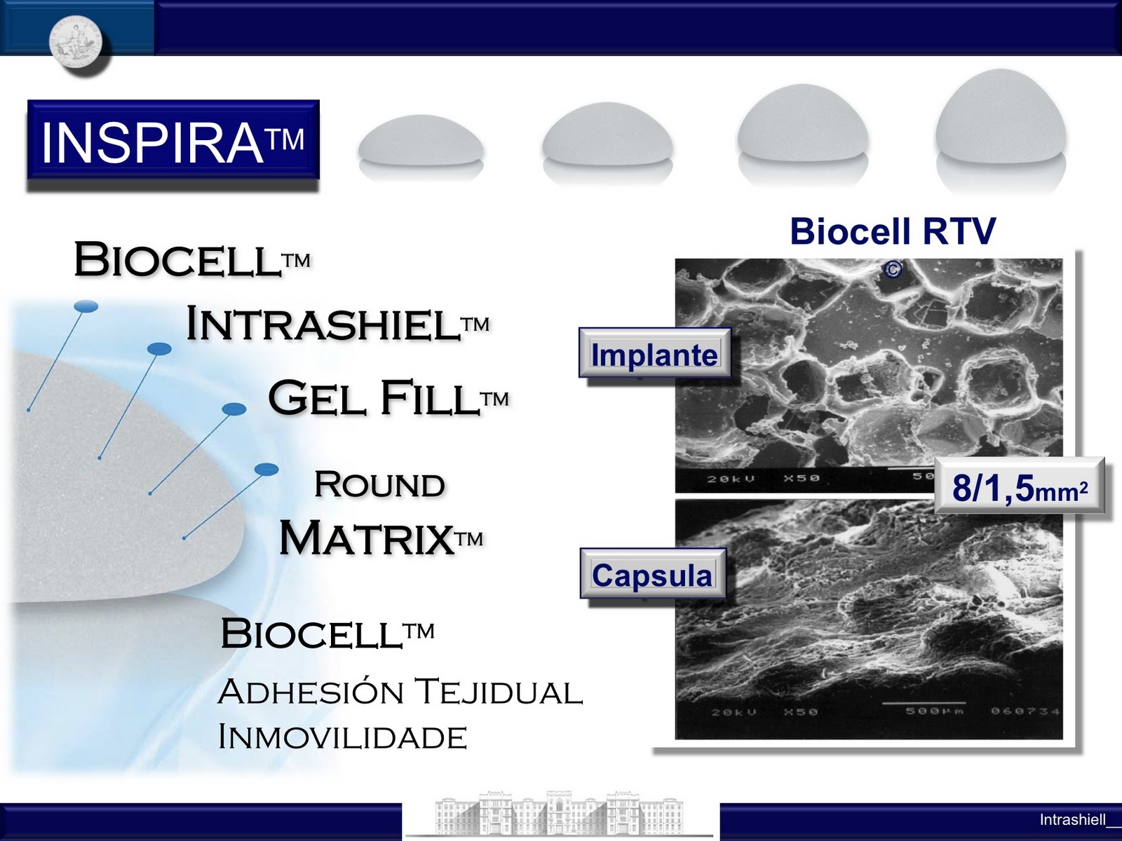 Implante Mamário de Silicone: Inspira Style Natrelle.... será a última ...