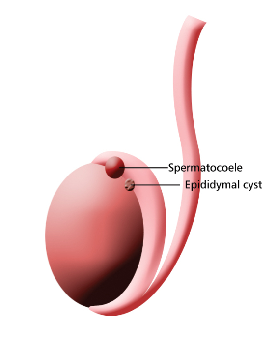 What The Bump On Your Scrotum Might Be And How To Treat It