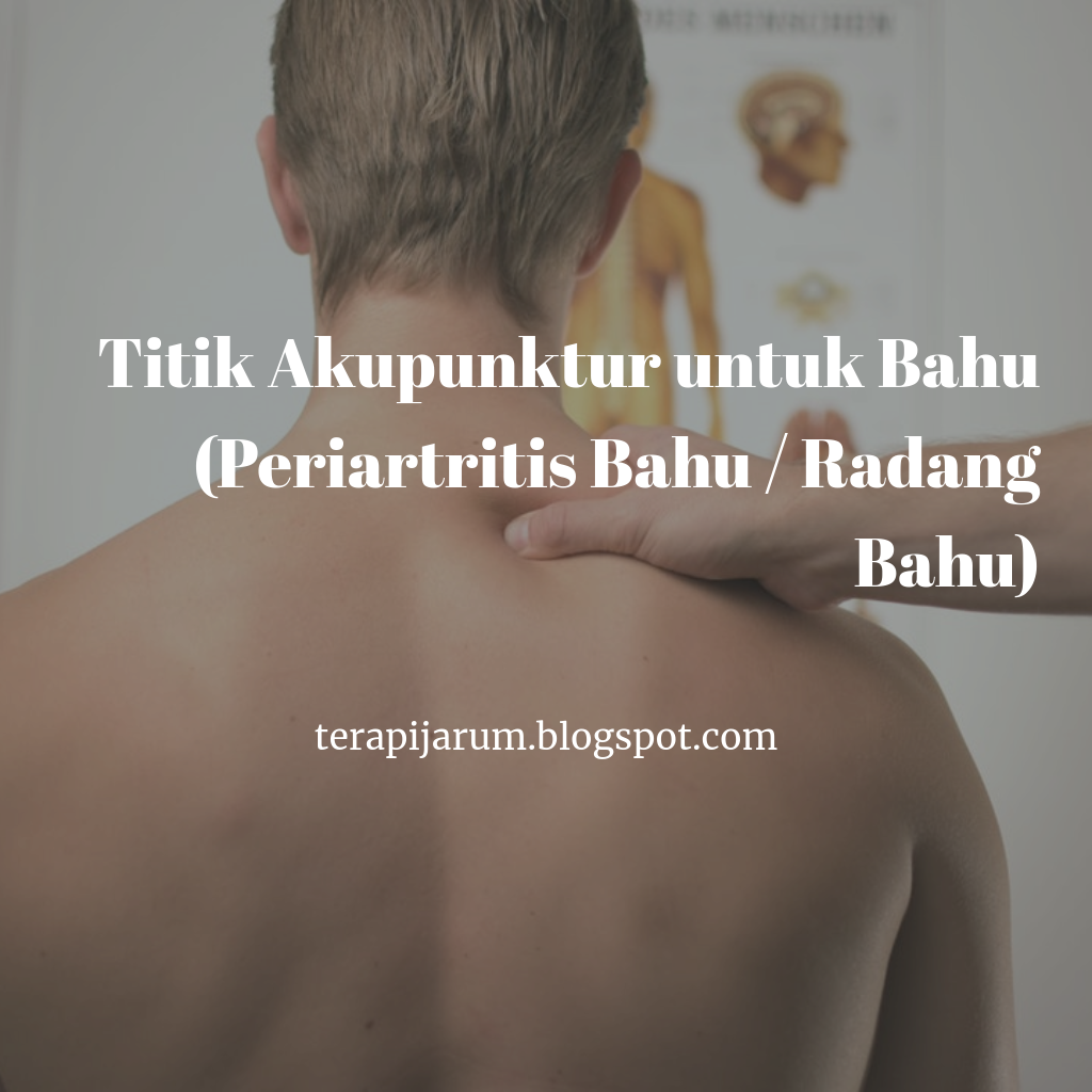 Titik Akupunktur untuk Bahu (Periartritis Bahu / Radang Bahu) - Terapi ...