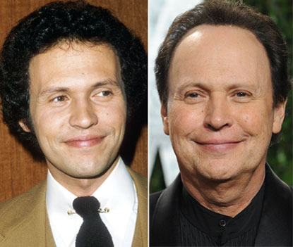 Billy Crystal Plastic Surgery