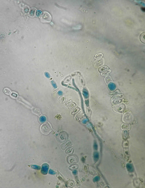 ATLAS MICOLOGIA: TRICHOPHYTON VERRUCOSUM