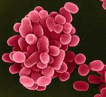 TEMA V MICROBIOLOGIA