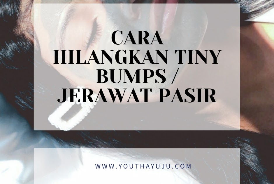Cara Merawat Tiny Bump cara-merawat-tiny-bump