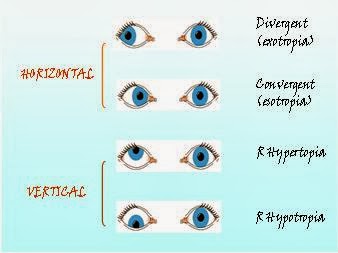 Pena Kehidupan: MATA JULING