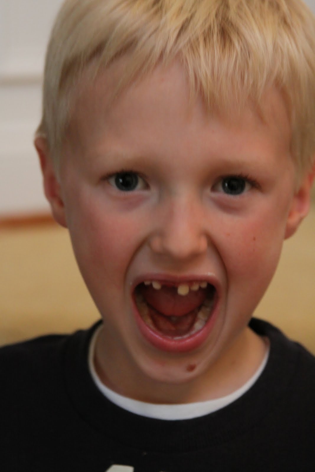 The Jenkins Family: A big tooth gone