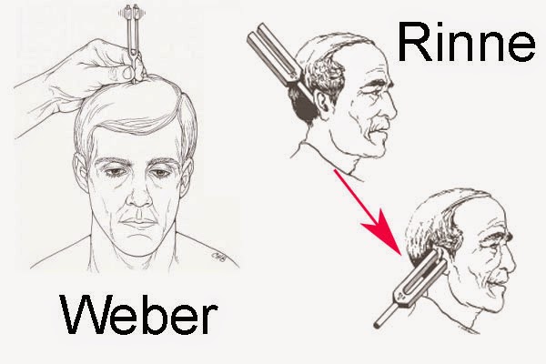 Neuro Brasil: Testes de Rinne e Weber para nunca mais esquecer!