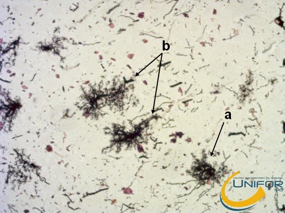 Atlas Histológico UNIFOR-MG: Astrócitos