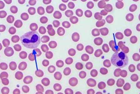 Lecture Notes in Medical Technology: Lecture #9 : The White Blood Cells