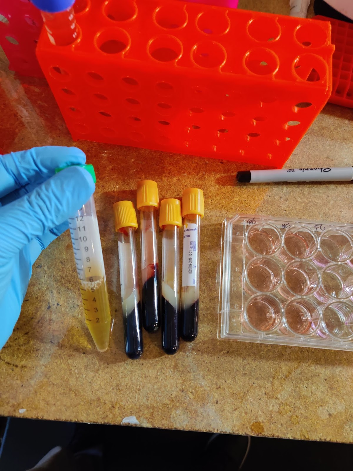 Science, Art, Beauty: Using My Own Blood Serum For Human Tissue Culture