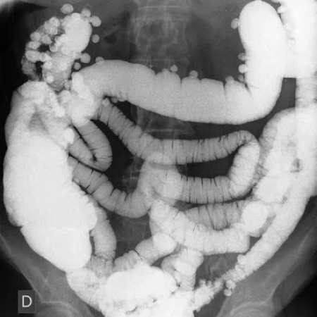 PROTOCOLOS IMAGENOLOGIA