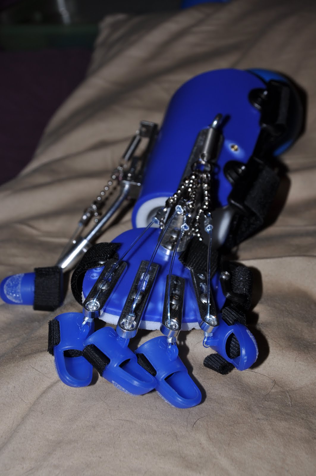 The Boy With the Mechanical Hand