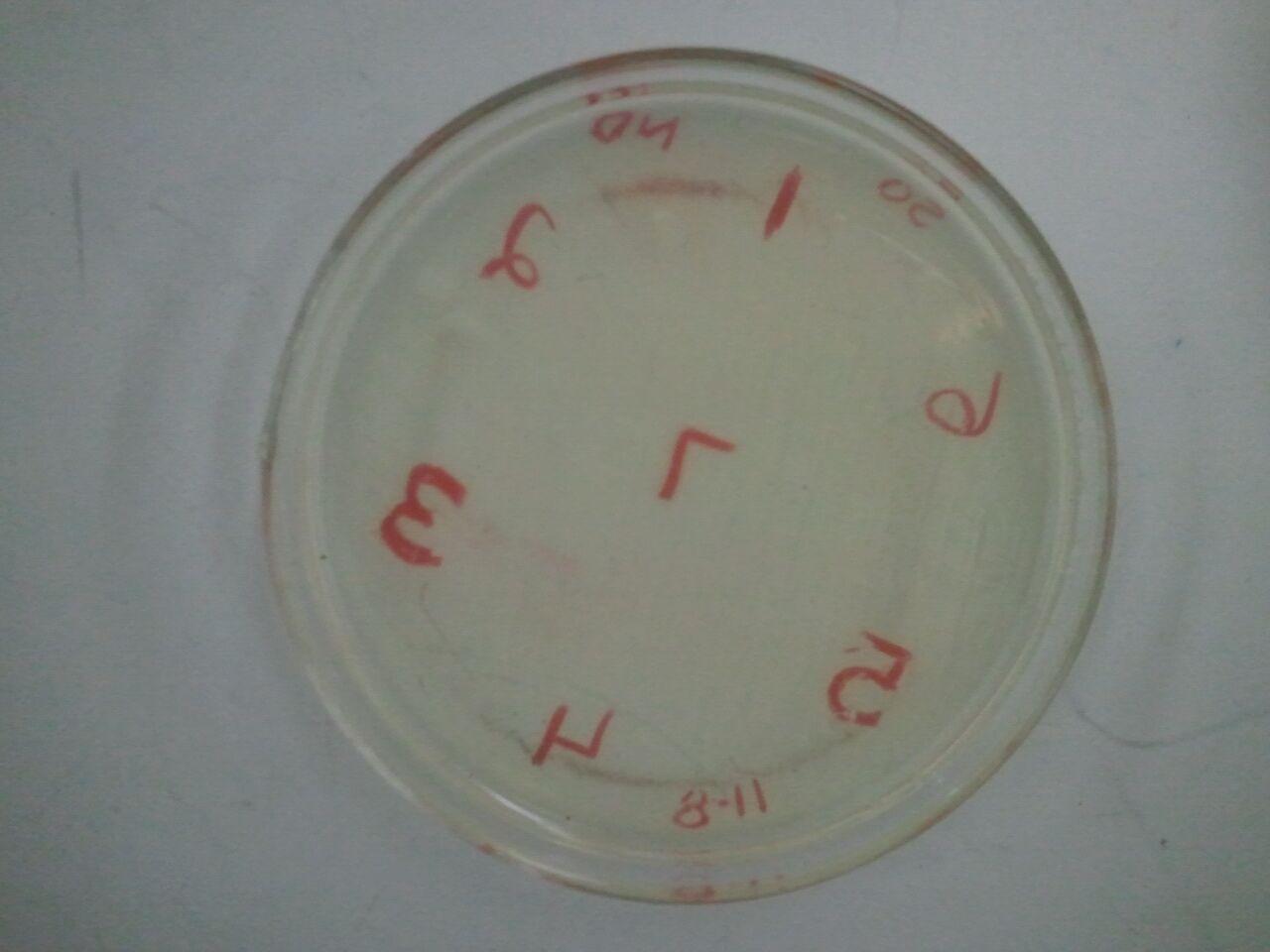 Microbiology Lab: Lab 11/8: Nitrate, Citrate, Urea, Indole