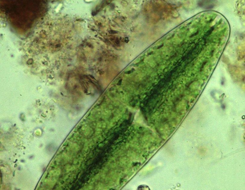 Microorganismos: Protistas