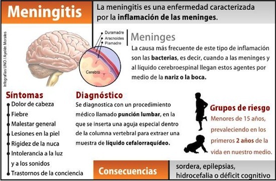 Un niño con meningitis