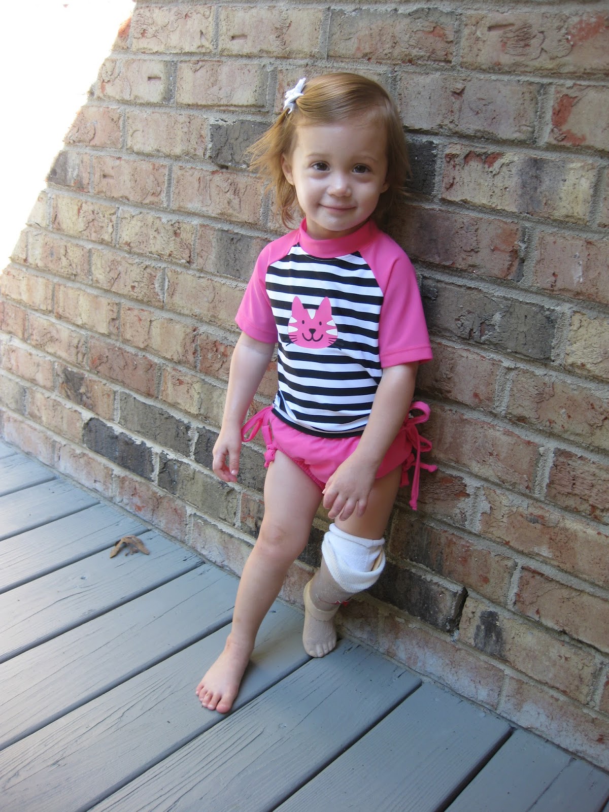 Beginning the Journey: Prosthetics, Potty training, and Pictures
