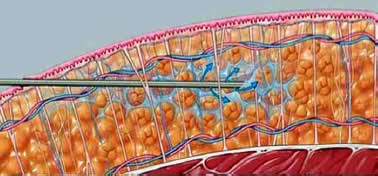 M de mimar: Mesoterapia virtual o inyectada