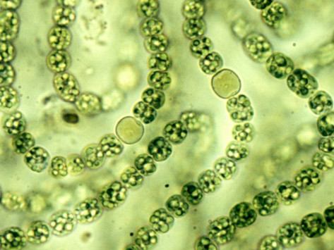 Nostoc Under Microscope