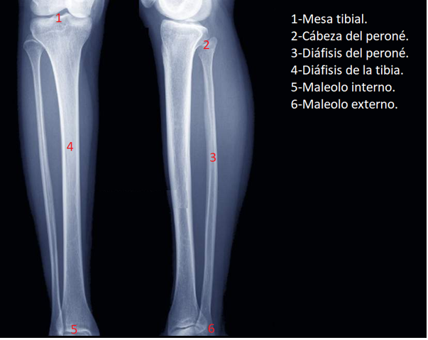Conceptualización Anatómica: Pierna, rodilla y fémur.