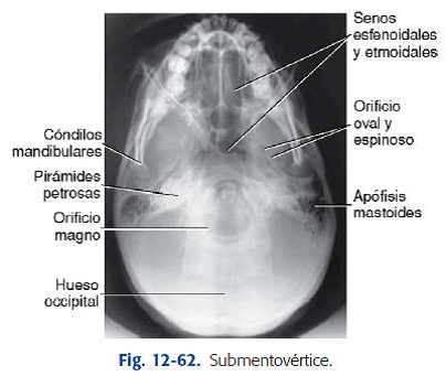 PRODUCCION Y TRATAMIENTO DE IMAGENES DIAGNOSTICAS: CAPITULO CRÁNEO Y ...