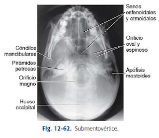 PRODUCCION Y TRATAMIENTO DE IMAGENES DIAGNOSTICAS: CAPITULO CRÁNEO Y ...