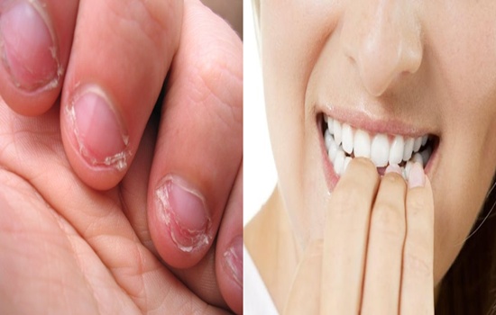 7 Best Tips To Stop Nail Biting - Best Homemade Tips