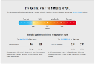 Dry Eye Blog from the experts at The Dry Eye Centre: TearLab Osmolarity ...