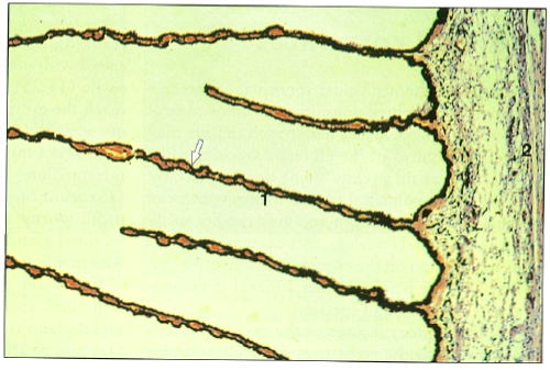 Eye Opener: Anatomy - Histology of the eye