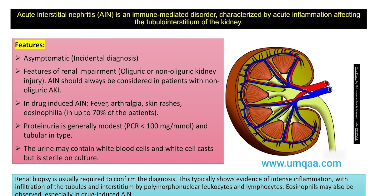 What are the causes of acute interstitial nephritis (AIN)?