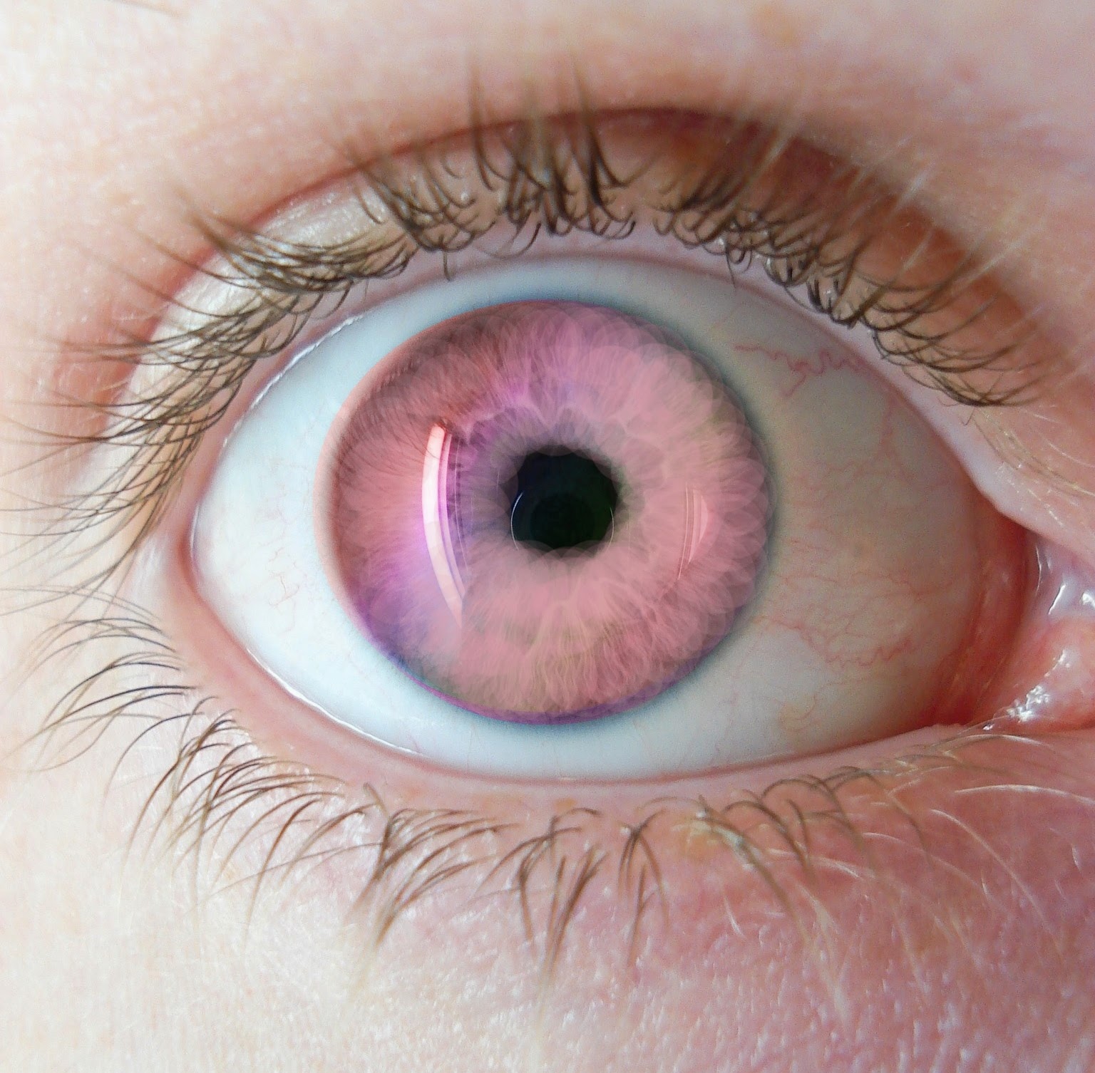 Macarena & Daniel: Cambio de ojo multicolor a ojo rosa