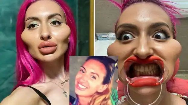 'Needs to grow bigger' This Instagram model with the biggest cheeks in ...