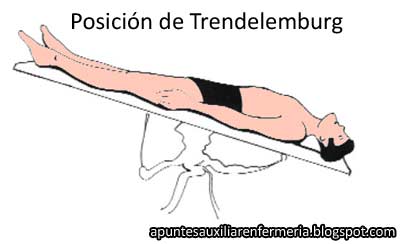 Posición de Decúbito Supino | APUNTES AUXILIAR ENFERMERIA