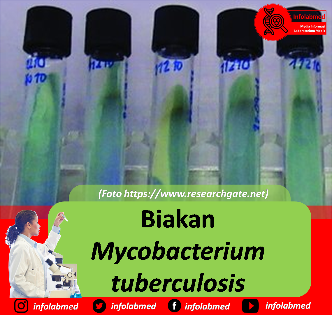 Biakan Mycobacterium tuberculosis